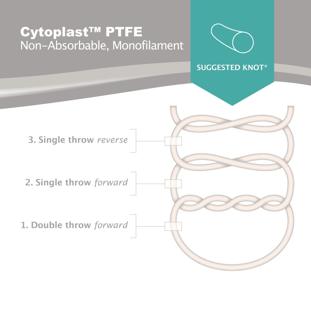 CS0618RC – USP 4/0 white suture with a 16 mm 3/8 circle precision ...
