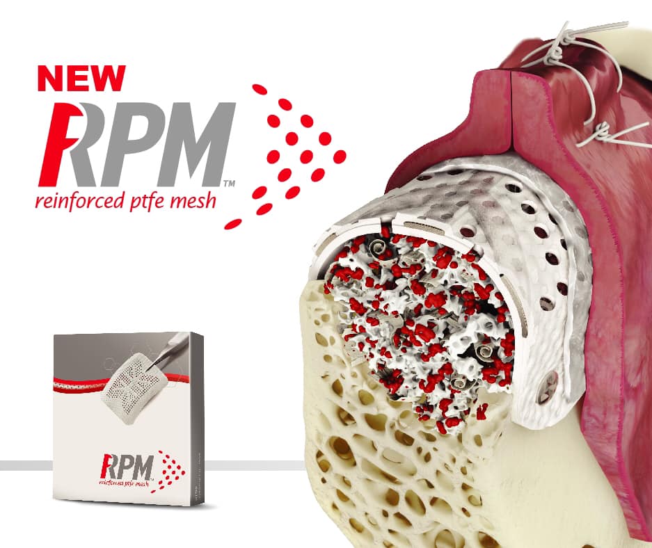 Collagen Membranes. dPTFE Membranes. Ridge Augmentation Mesh – PRM ...